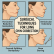 Long Chin Surgery: 4 Surgical Solutions for Symmetry